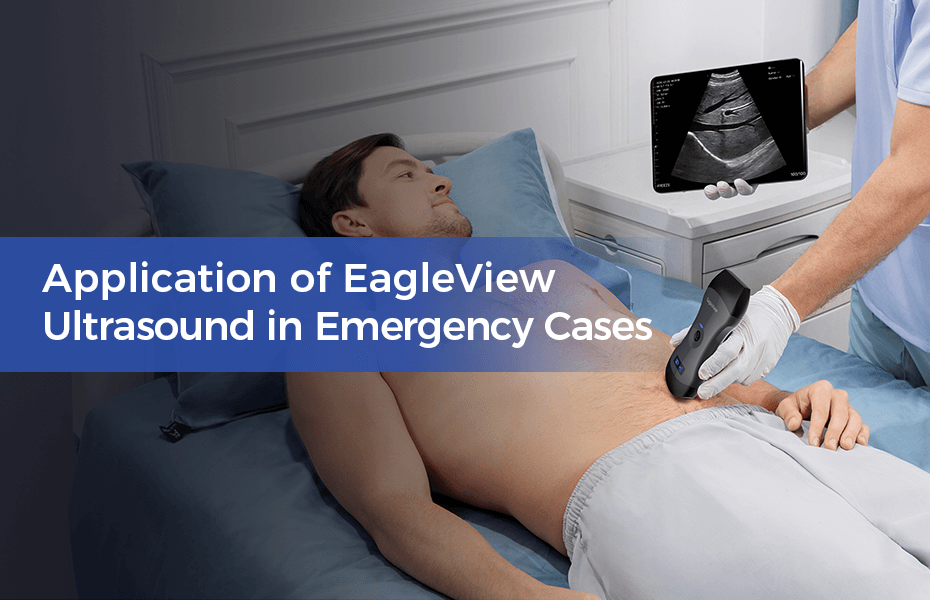 Application of EagleView ultrasound in emergency cases in small clinic
