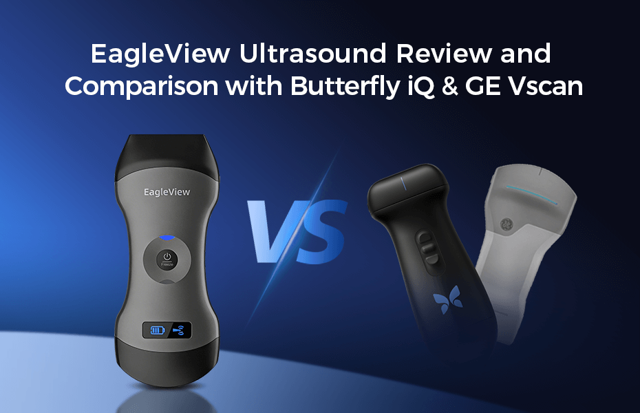 EagleView Ultrasound Review and Comparison with Butterfly iQ+