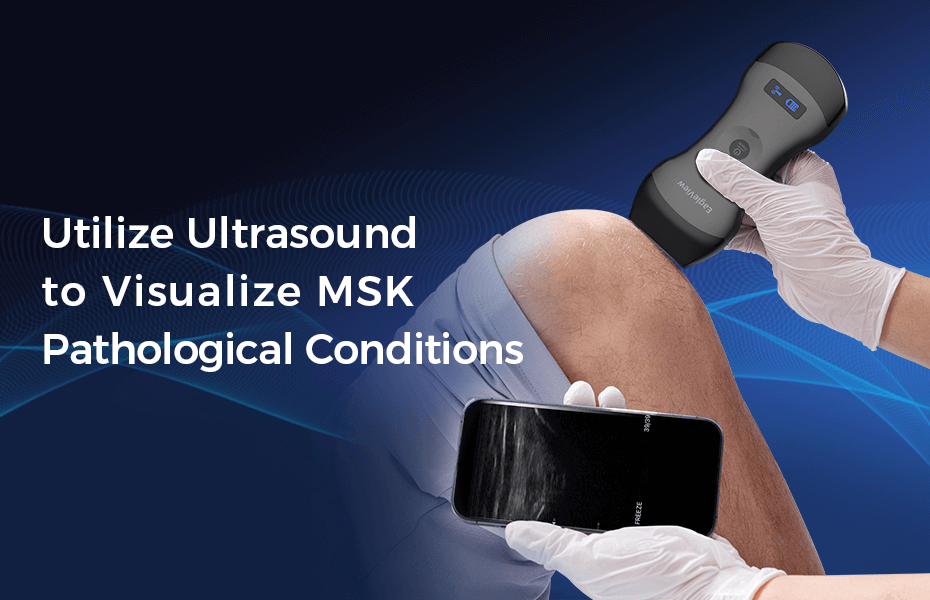 EagleView Portable Ultrasound for MSK Imaging: Orthopedist Review