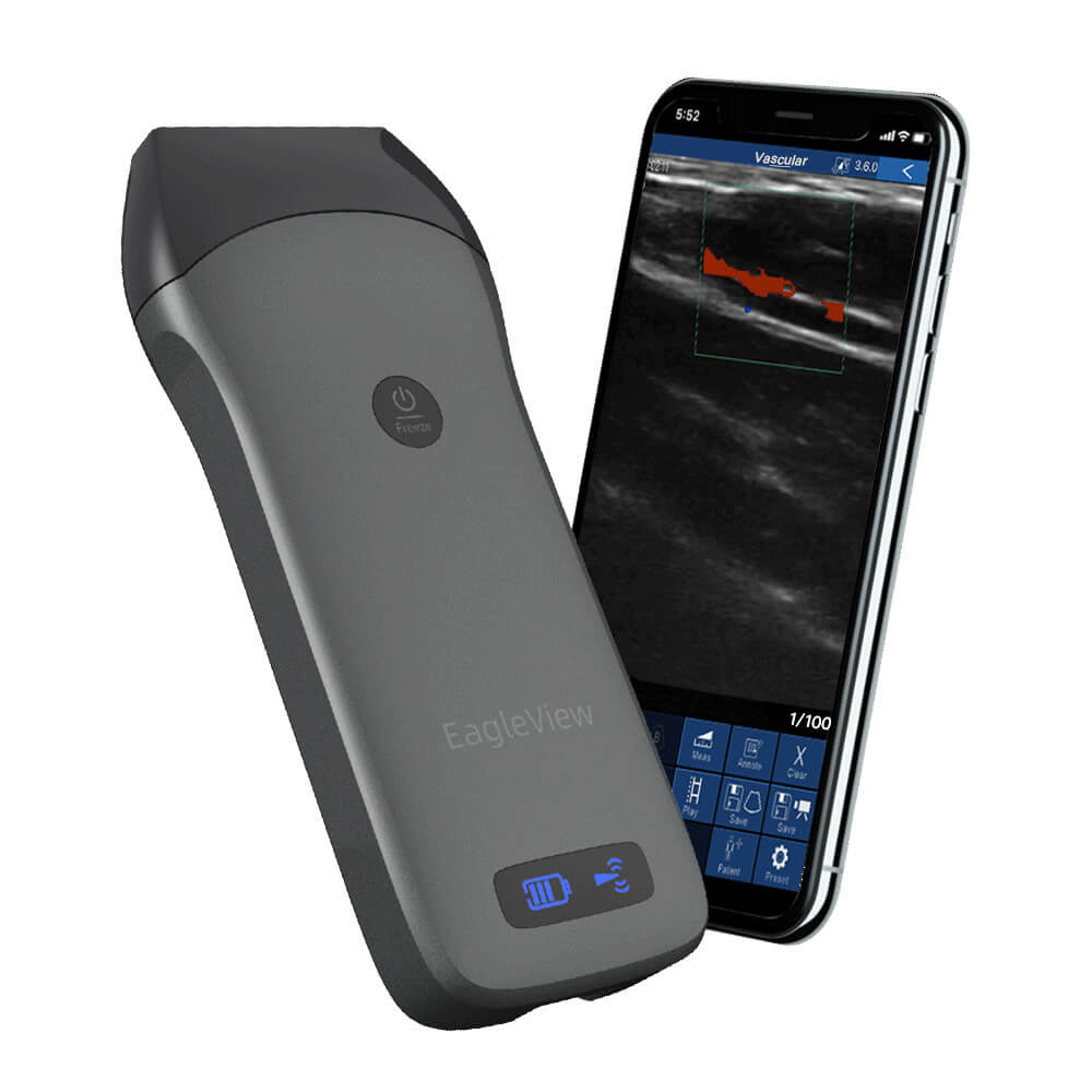 EagleView 線性探頭車